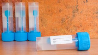 Fecal Testing for Cats — 7 Common Questions Answered