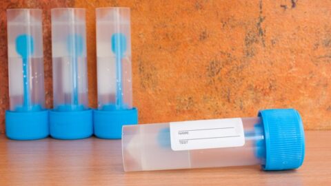 Fecal Testing for Cats — 7 Common Questions Answered